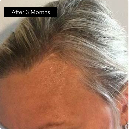 REVOLVE Women's Trio Kit – Zenagen